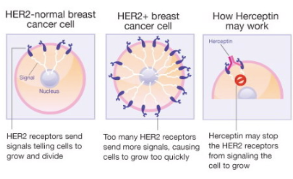 Breast Cancer Subtypes – HER2 positive (HER2+) Disease | Talking Tatas
